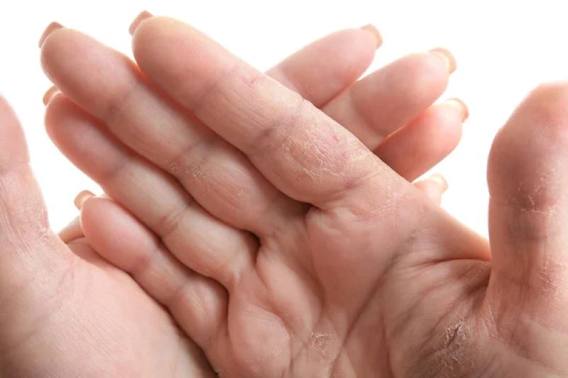 SERT Gene & Skin Picking: Your Brain's Stress Response | Zanova